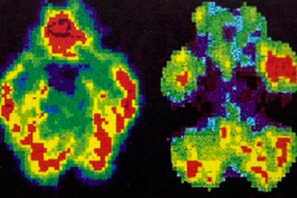 What Is It like to Be an Octopus? - Boston Review